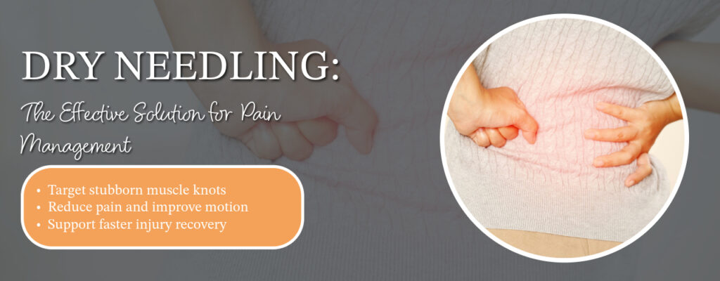 Dry Needling: The Effective Solution for Pain Management - Amplify ...